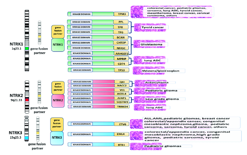 Tumors showing TRK (tropomyosin receptor kinase) gene fusion ...
