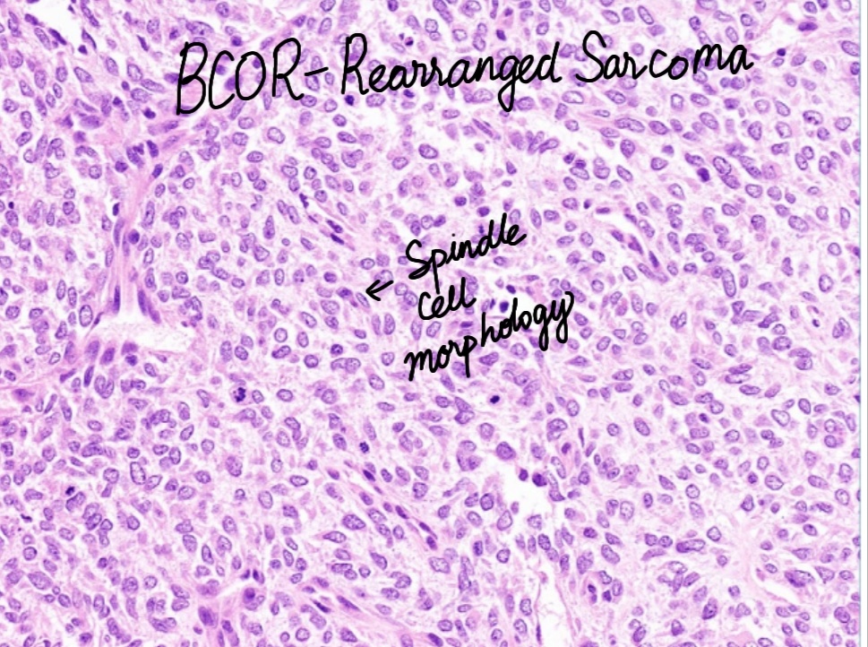 Pathology MCQs for various entrance exams