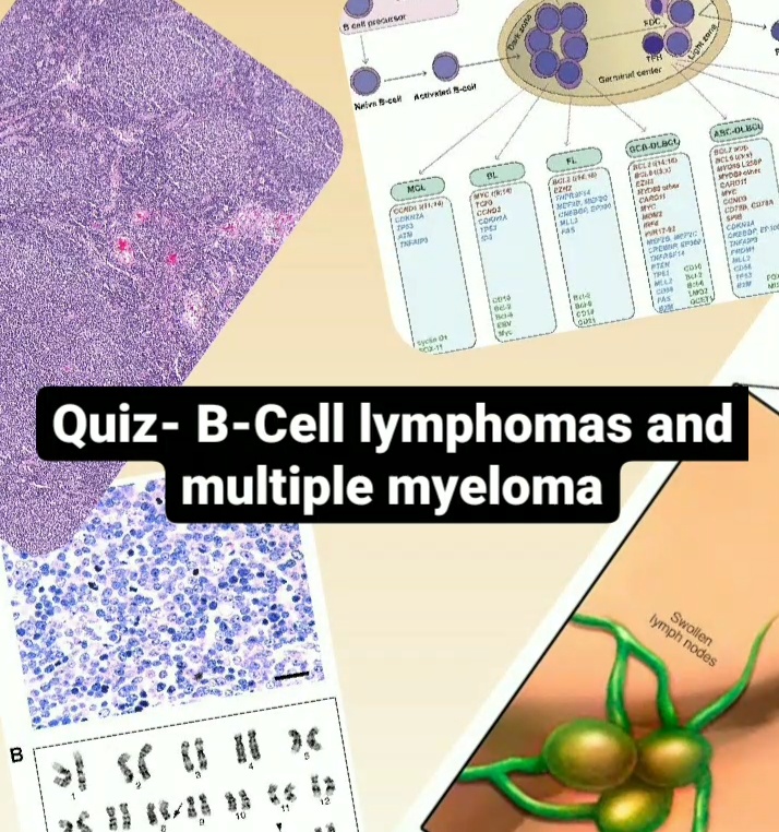 B-Cell Lymphomas and Multiple Myeloma Hematopathology Mcqs - PATHOLOGY MCQs