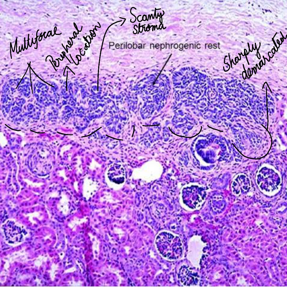 Pathology MCQs for various entrance exams
