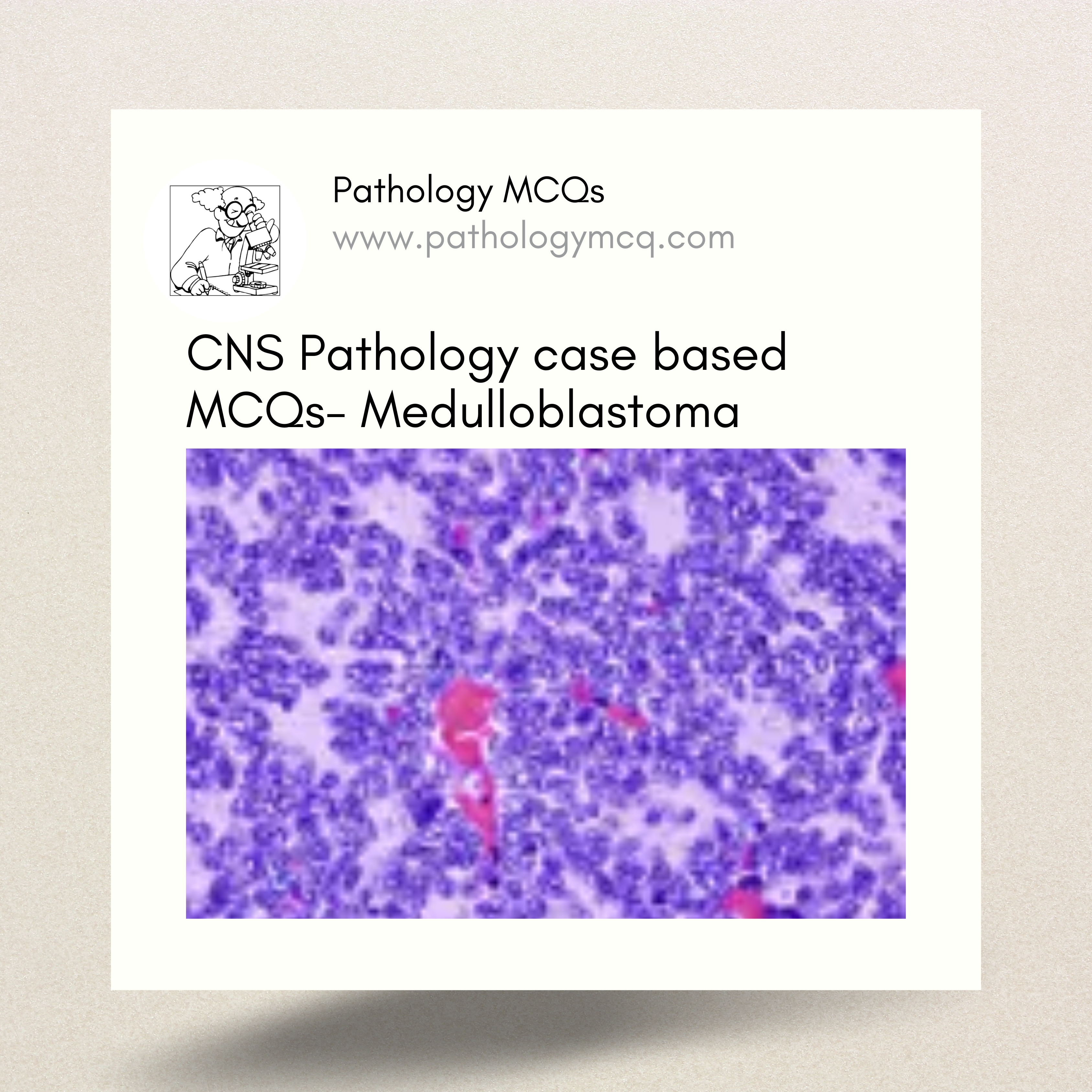 CNS Pathology case based MCQs- Medulloblastoma - PATHOLOGY MCQs