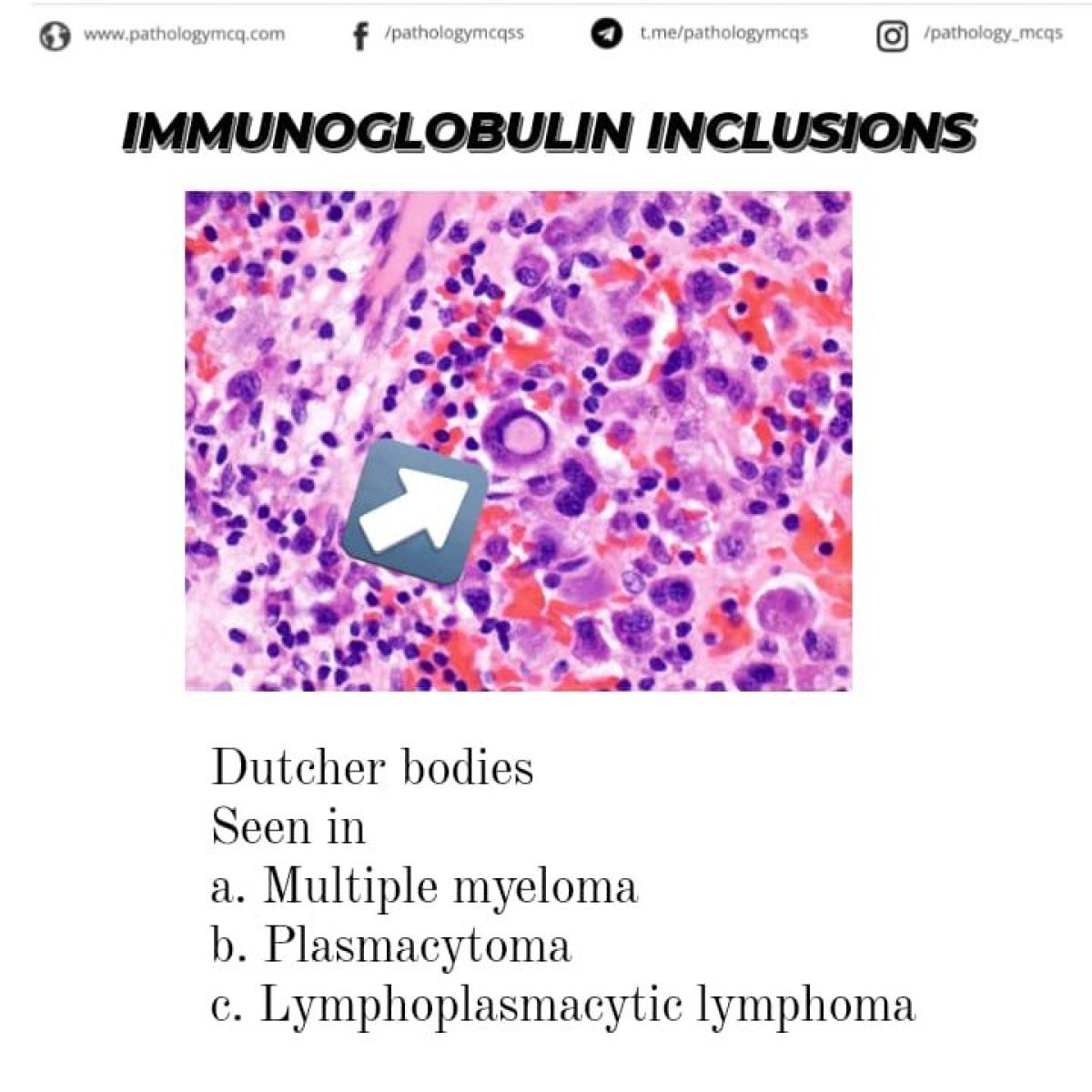 NUCLEAR INCLUSIONS AND PSEUDO-INCLUSIONS - PATHOLOGY MCQs