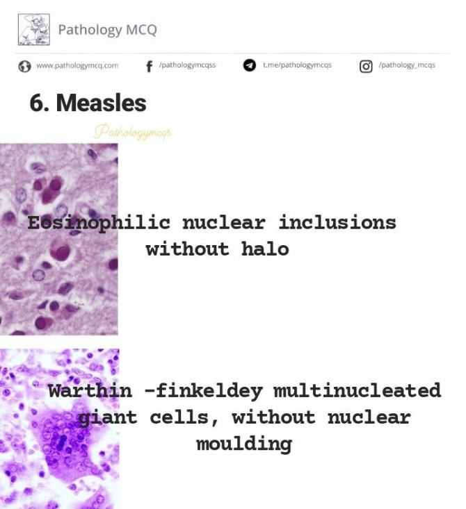 NUCLEAR INCLUSIONS AND PSEUDO-INCLUSIONS - PATHOLOGY MCQs