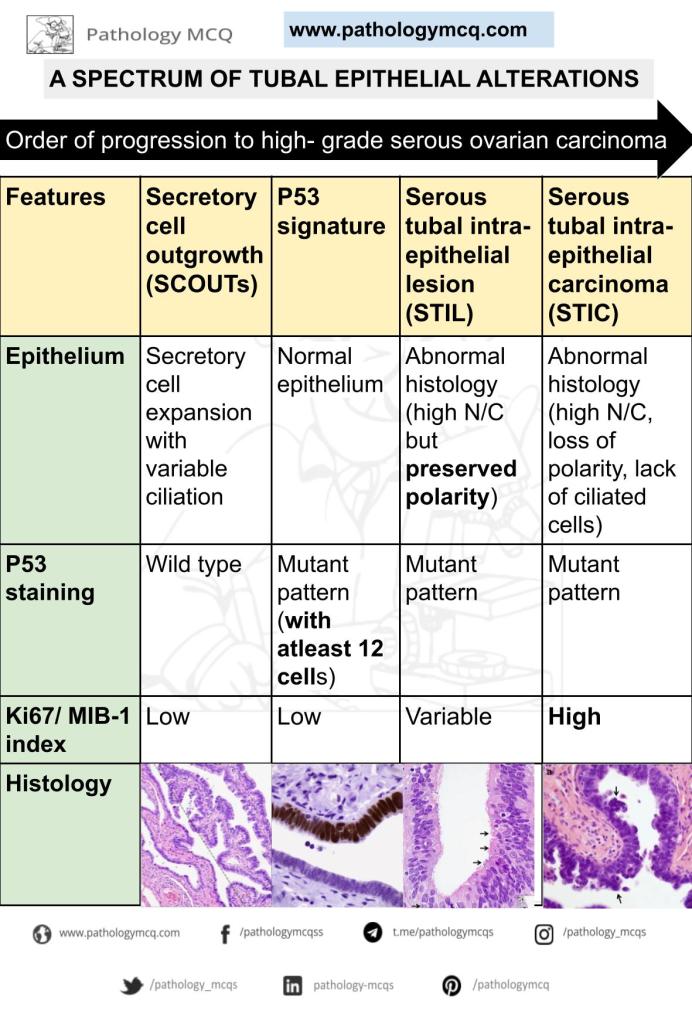 P53 Signature Lesion in Ovarian Tumors: Histological Features and ...