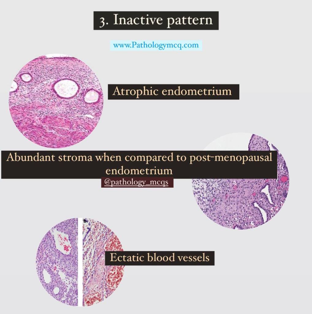 Morphological endometrial patterns associated with exogenous progestins ...