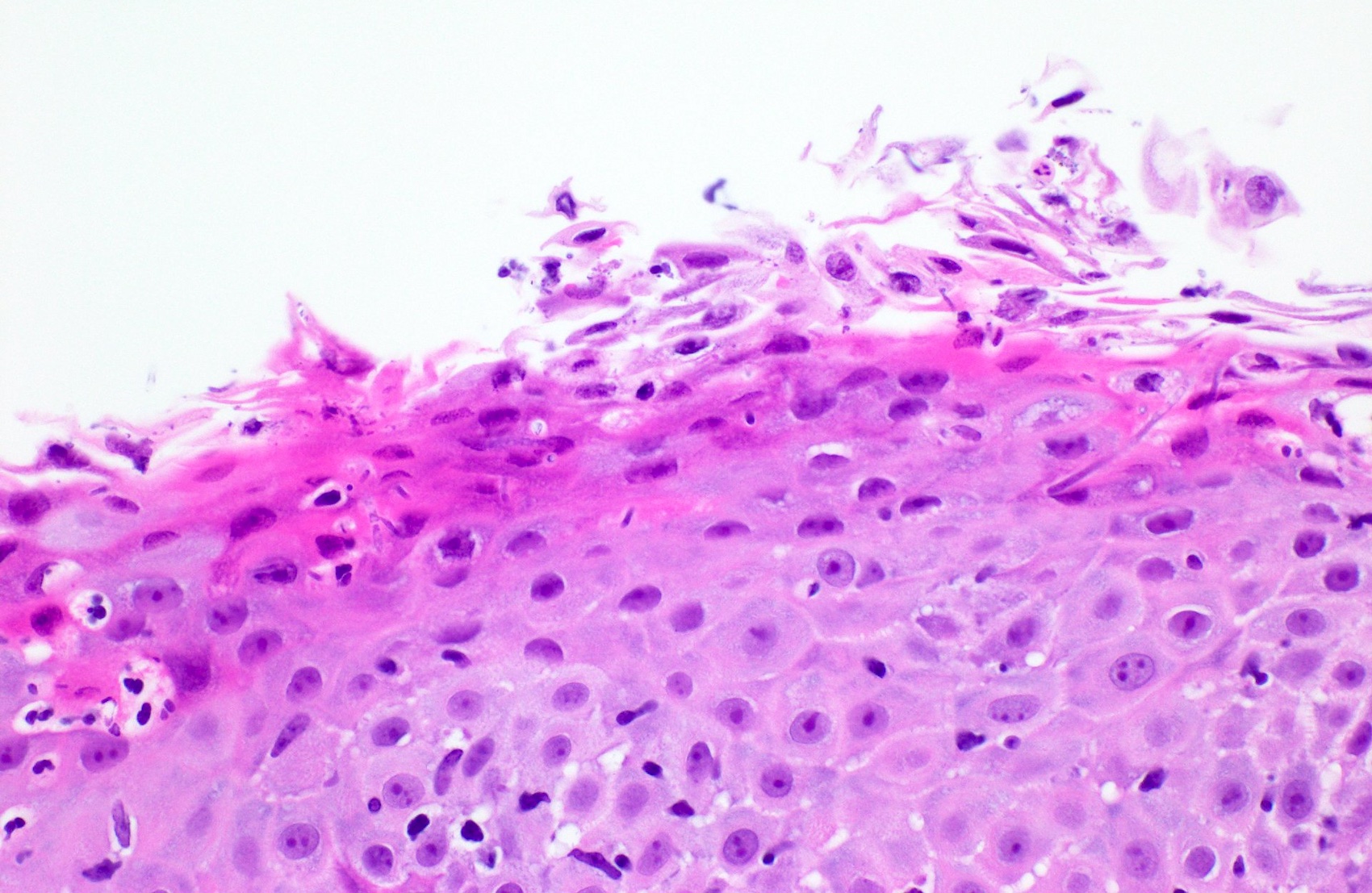 Pathology MCQs for various entrance exams