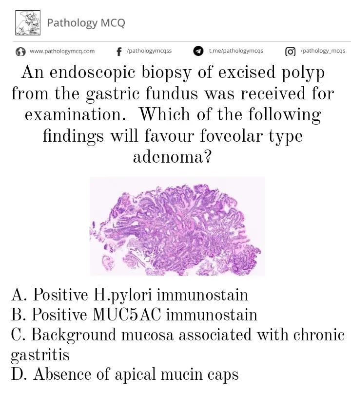 Navigating the Microscopic Maze: Differentiating Intestinal and ...