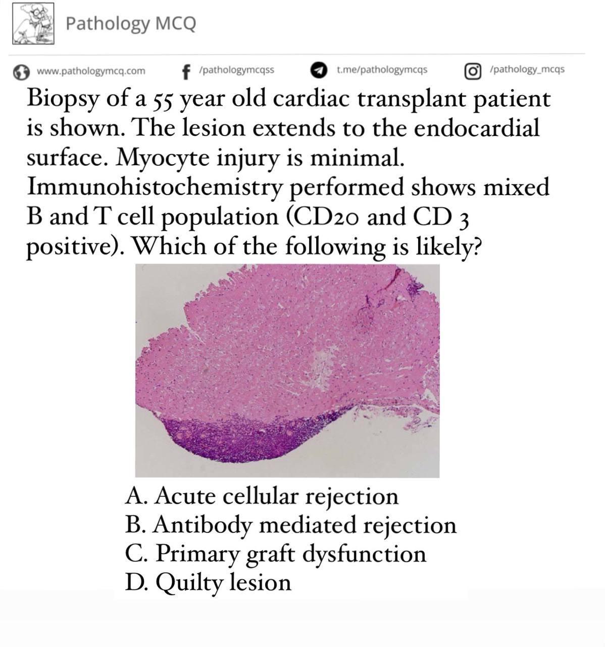 Pathology MCQs for various entrance exams