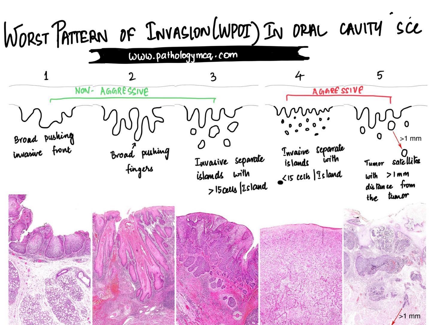 Pathology MCQs for various entrance exams