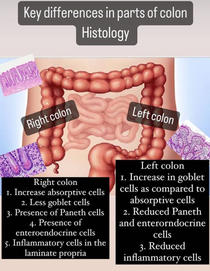 Paneth cells and Paneth cell metaplasia- Significance - PATHOLOGY MCQs