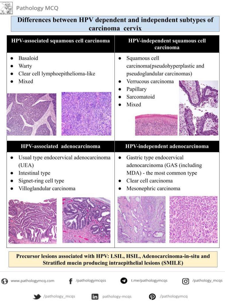 Understanding the Histopathologic Variants of Cervical Carcinomas and ...