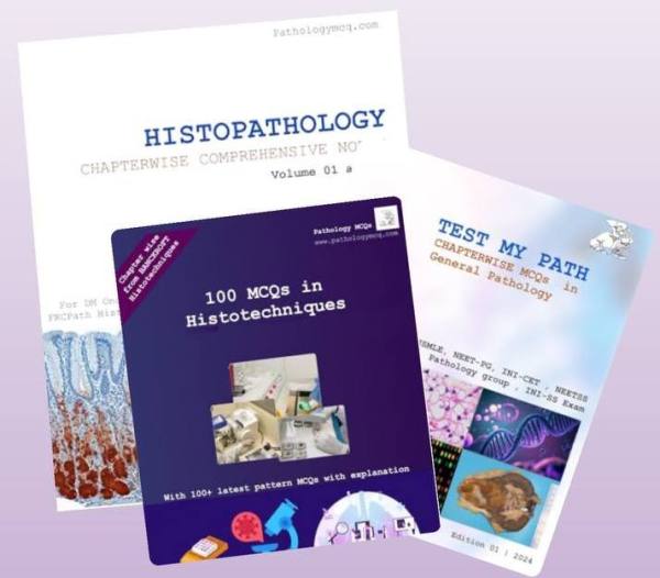 Robbins pathology question bank - PATHOLOGY MCQs