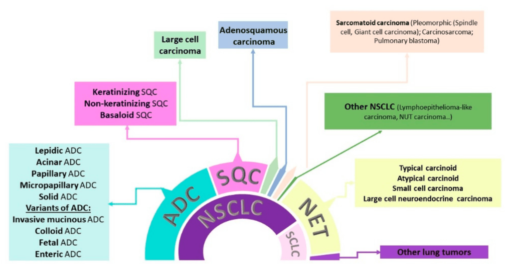 Stepwise Algorithmic Approach to IHC-Based Diagnosis of Lung Carcinoma ...