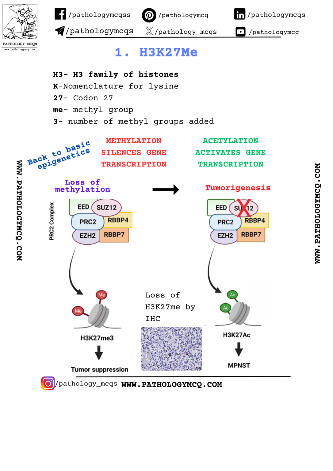 Tumors Associated with Histone H3 Mutations - PATHOLOGY MCQs