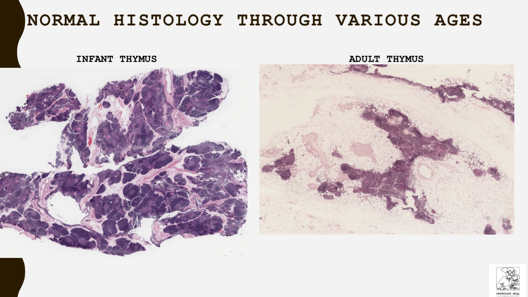 Normal Histology of the Thymus