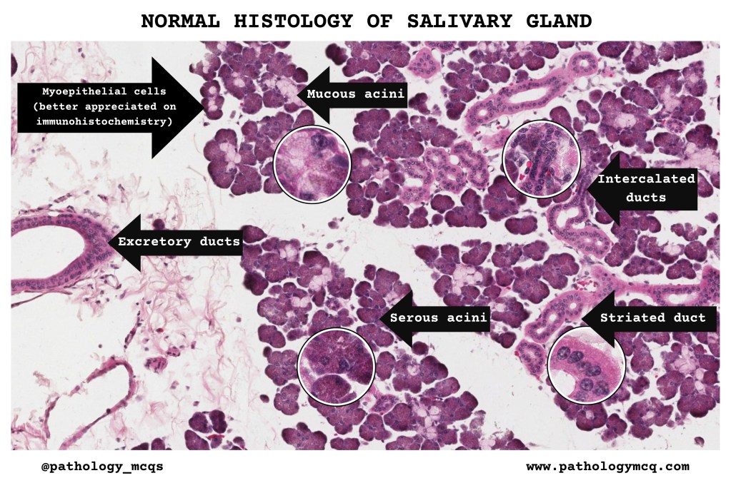 The salivary glands are critical for oral health, responsible for ...