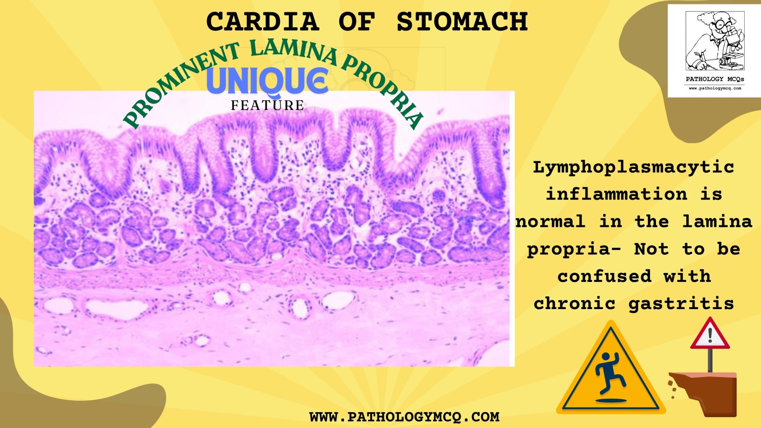 Histology of the Esophagus and Stomach: A Comprehensive Overview ...