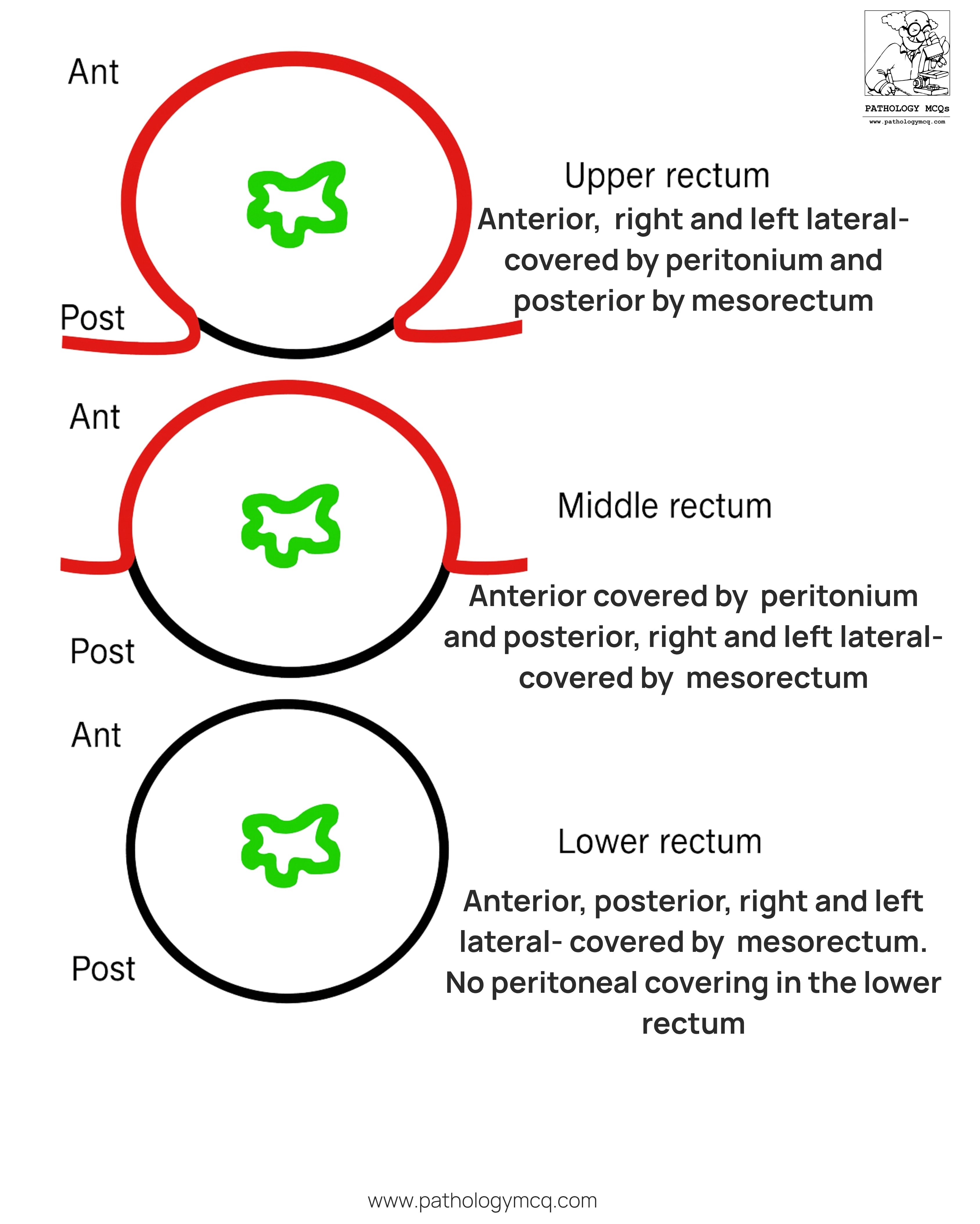 🧾 Gross Pearls: Anatomy & Surgical Resection of the Rectum - PATHOLOGY MCQs