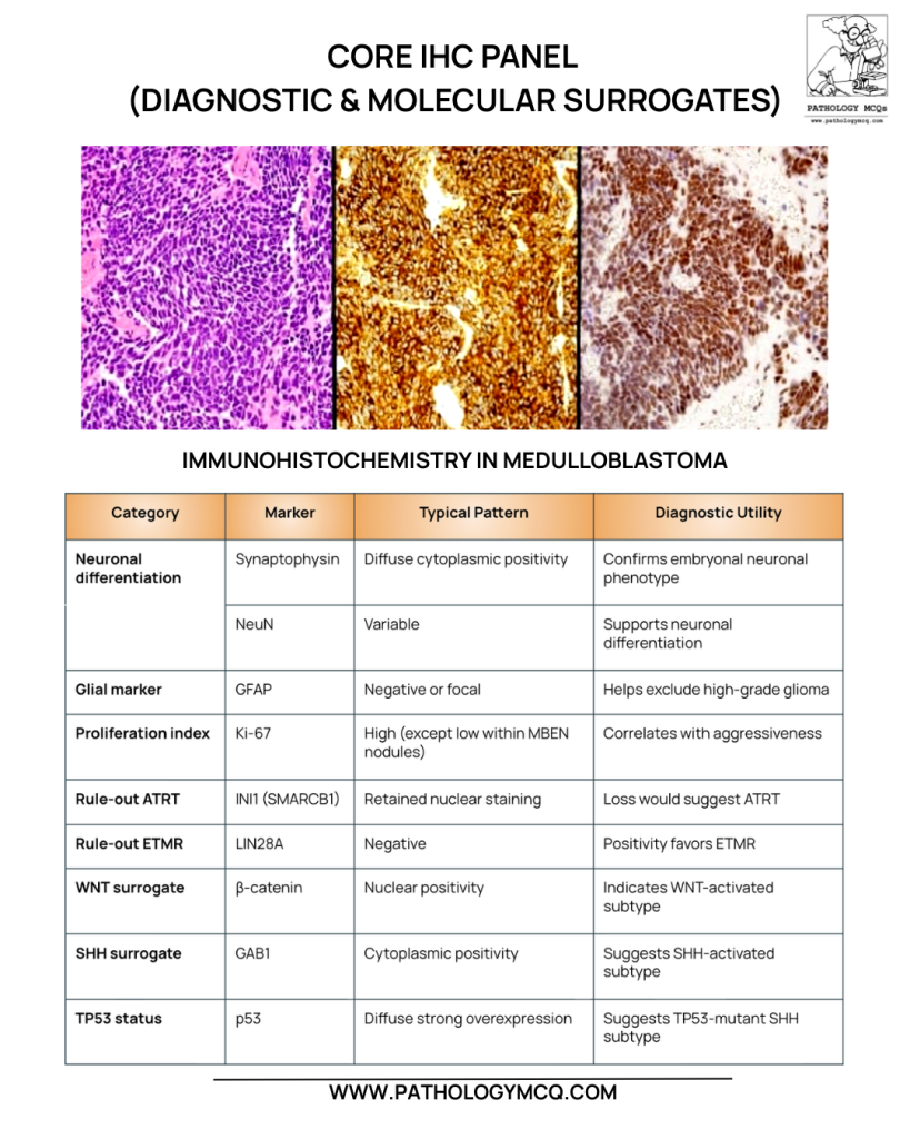 Medulloblastoma Pathology – Morphology, Immunohistochemistry and WHO ...