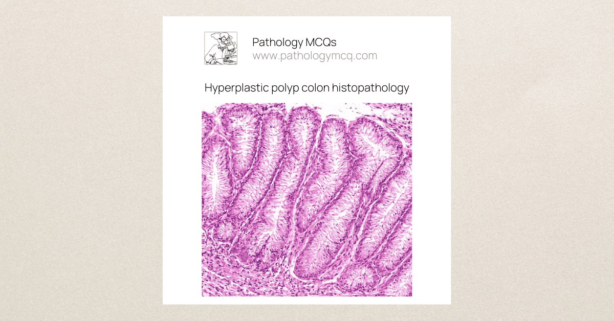 Hyperplastic Polyp Pathology: Histology, Diagnosis, MCQs & Differentiation